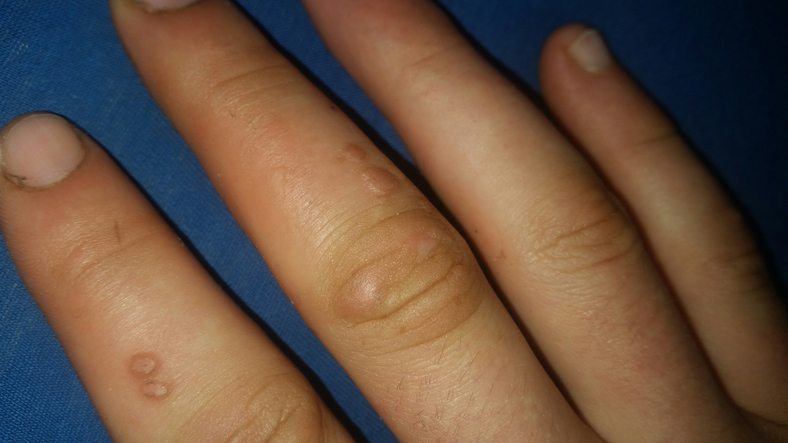 2.06 Skin Disorders and Diseases